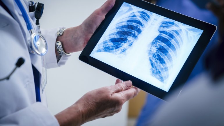 Trichterbrust (Pectus excavatum): Symptome & Behandlung