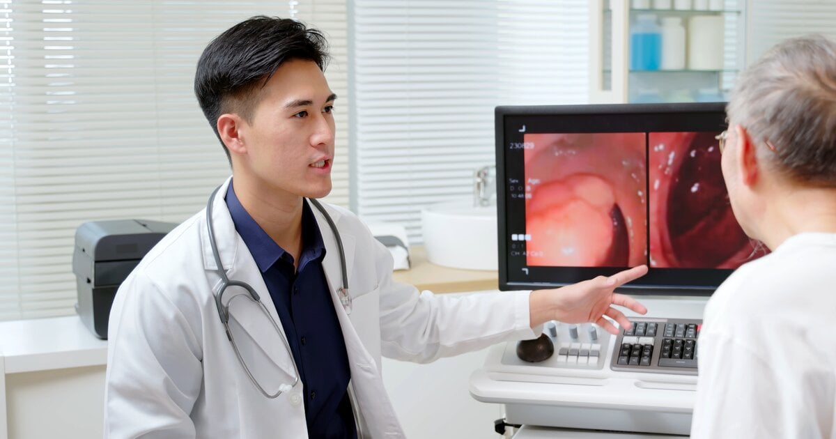 Darmpolypen: Anzeichen, Ursachen und wann entfernen?