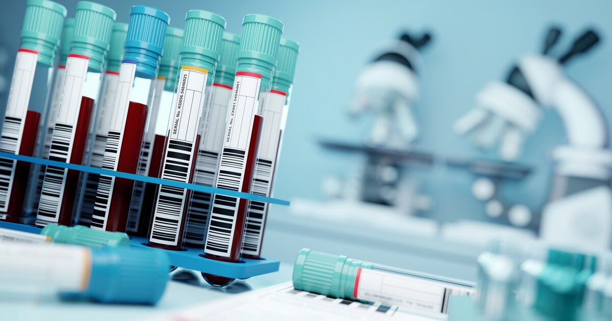 Quick-Wert: Wann zu hoch oder zu niedrig?